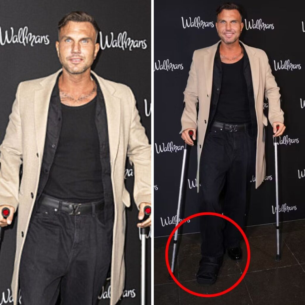 Marc Ciano i trist ulykke: – Den værste smerte, jeg nogensinde har ...